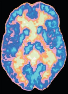 This Is Your Brain On Zen - Tricycle: The Buddhist Review